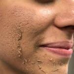 Algae Peel Is The Best Treatments For A Glowing Skin